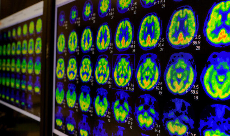 Mobile Diagnostic Imaging Services | AIMI